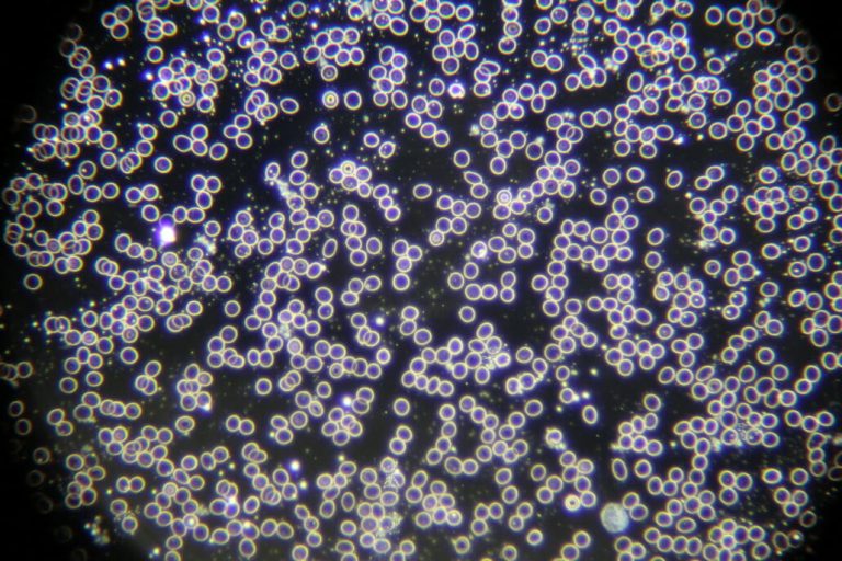 Dark field microscopy – electrosmog exposure visible during blood ...
